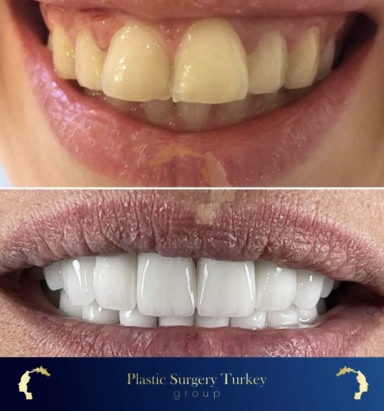 Expert Plastic Surgery in Turkey - Top Surgeons & Advanced Care | PSTG
