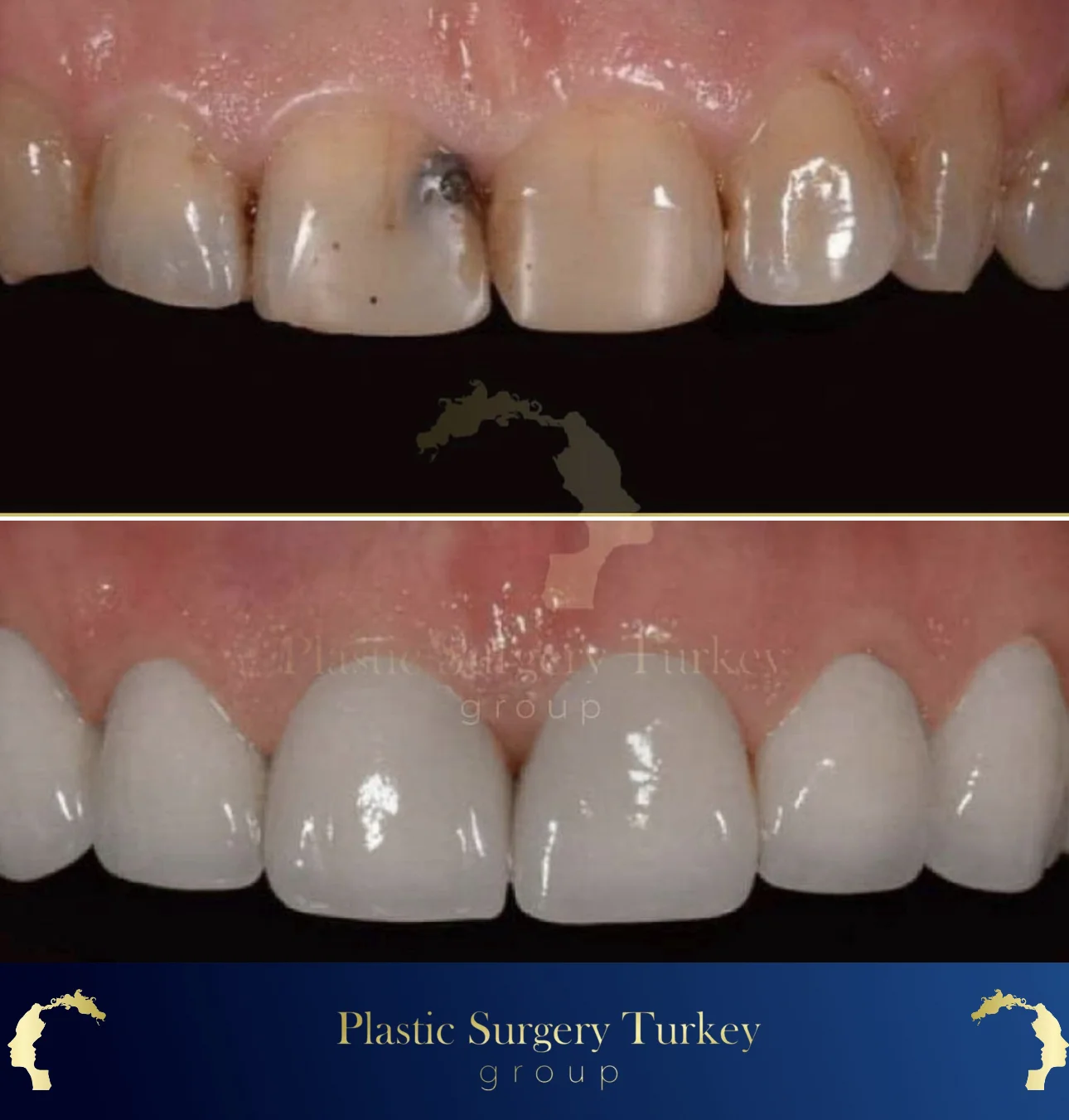 Expert Plastic Surgery in Turkey - Top Surgeons & Advanced Care | PSTG